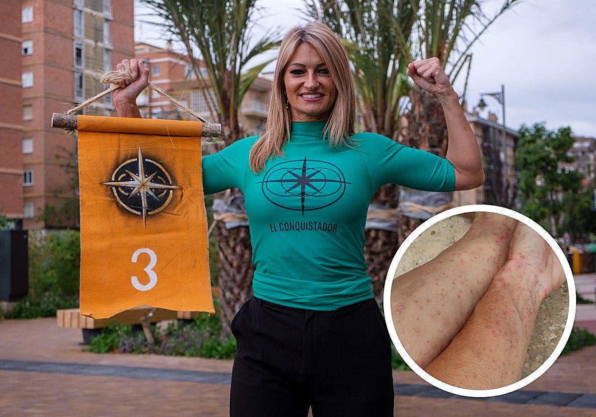 «No había más de un centímetro de mi cuerpo sin picotazos» | La Rioja